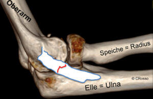 Die Ellenbogen-Anatomie - ARTHRO